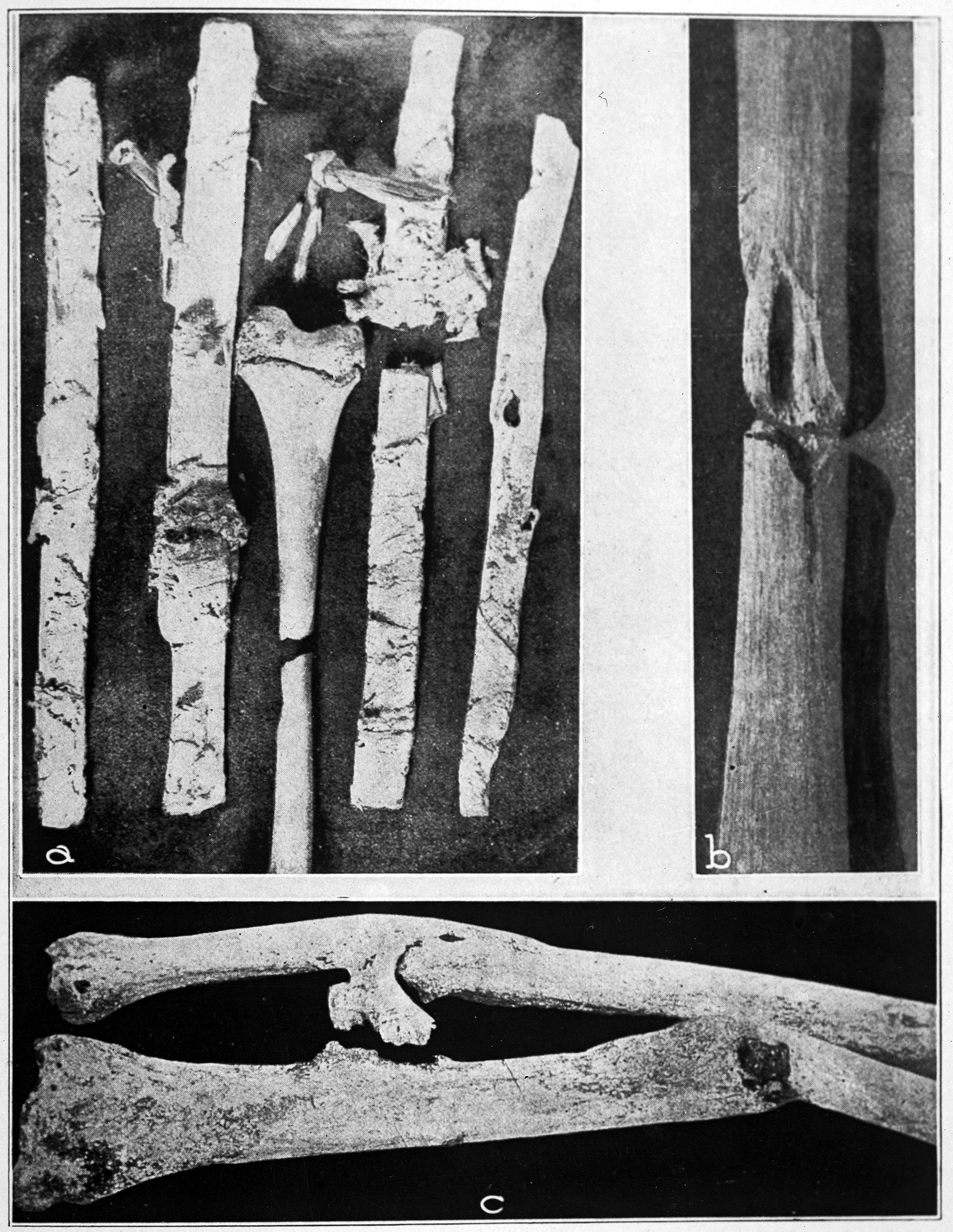 10 Major Contributions Ancient Egyptians Made to Modern Medicine