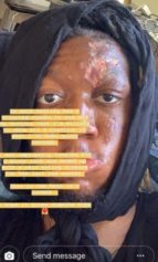 Rapper OG Maco Reveals He's Had Skin-Eating Disease That Nearly Cost ...