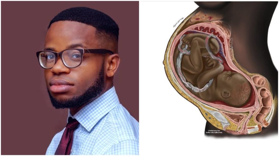 'Never Seen a Black Fetus Illustrated, Ever': Medical Student Made ...